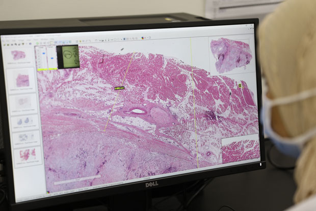 » Digital Pathology and Artificial Intelligence